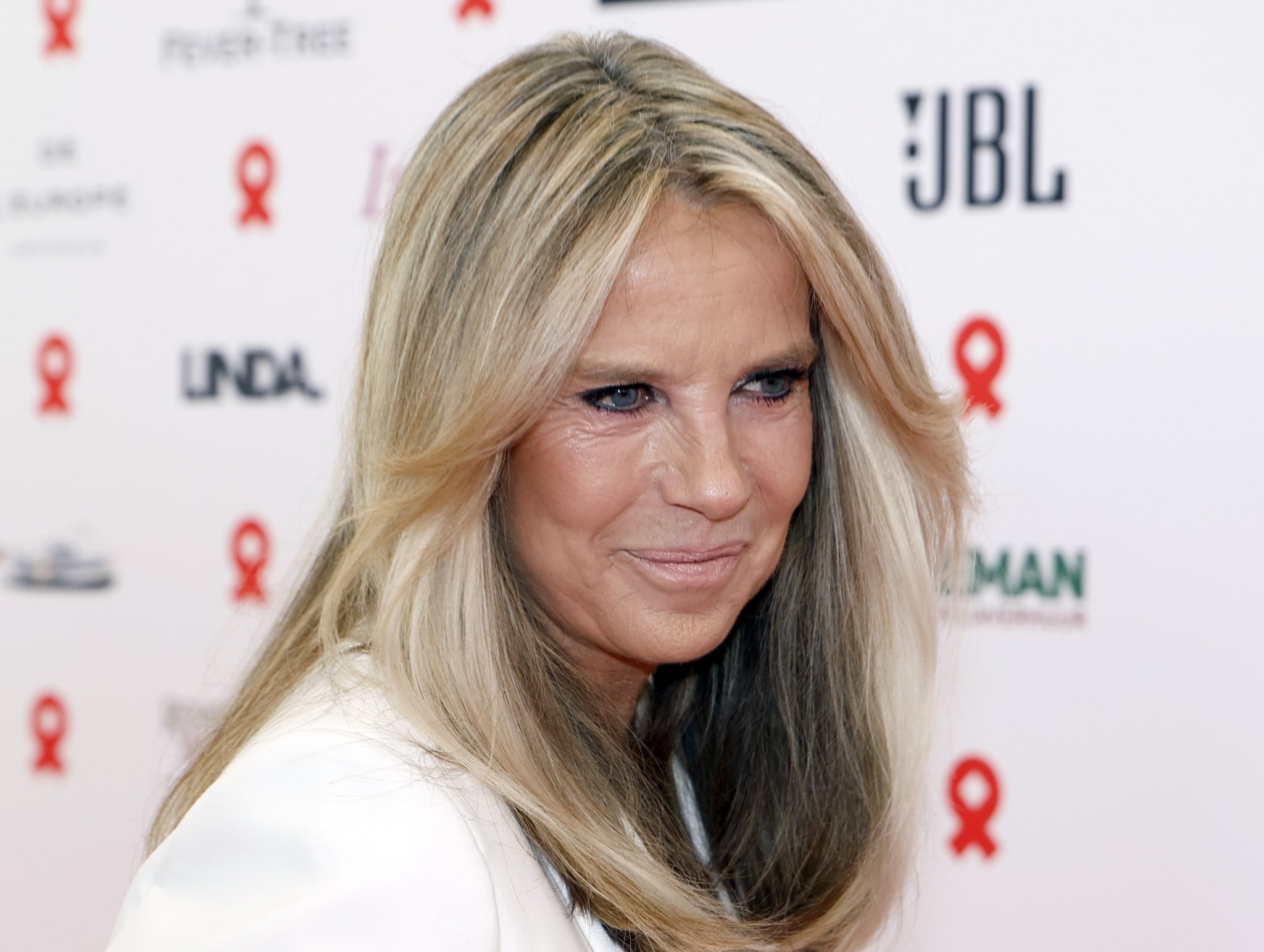 Pijnlijke ingreep voor Linda de Mol
